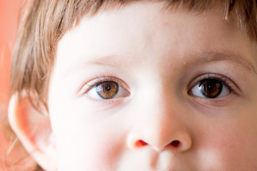 Glaucoma infantil: Diagnóstico antes del primer año puede evitar la ceguera